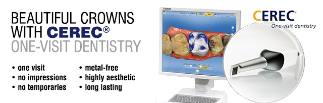 CEREC Dentist Kanata, ON | One Day Crowns